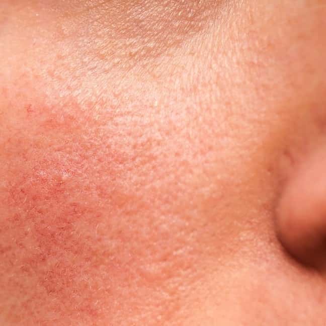 Skin Conditions We Treat - Viola Laser and Skin Care Clinic