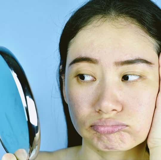 Skin Conditions We Treat - Viola Laser and Skin Care Clinic