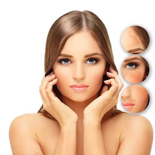 Skin Conditions We Treat - Viola Laser and Skin Care Clinic