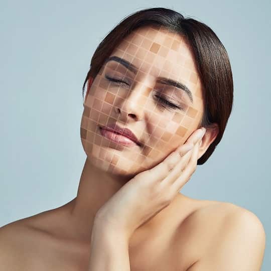 Skin Conditions We Treat - Viola Laser and Skin Care Clinic