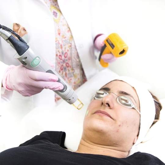 Redness & rosacea Treatment - Toronto - Viola Laser and Skin Care Clinic