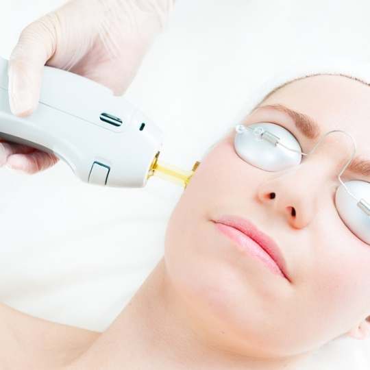 Redness & rosacea Treatment - Toronto - Viola Laser and Skin Care Clinic