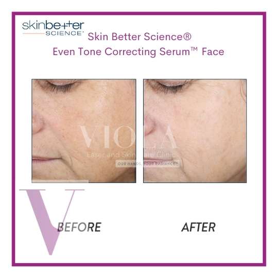 Skin Better Science Products in Toronto - Viola Laser and Skin Care Clinic