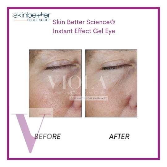 Skin Better Science Products in Toronto - Viola Laser and Skin Care Clinic