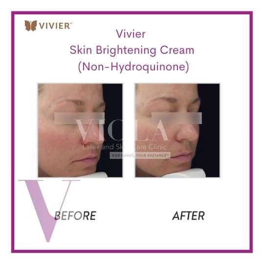 Vivier Skin Care Toronto - Viola Laser and Skin Care Clinic